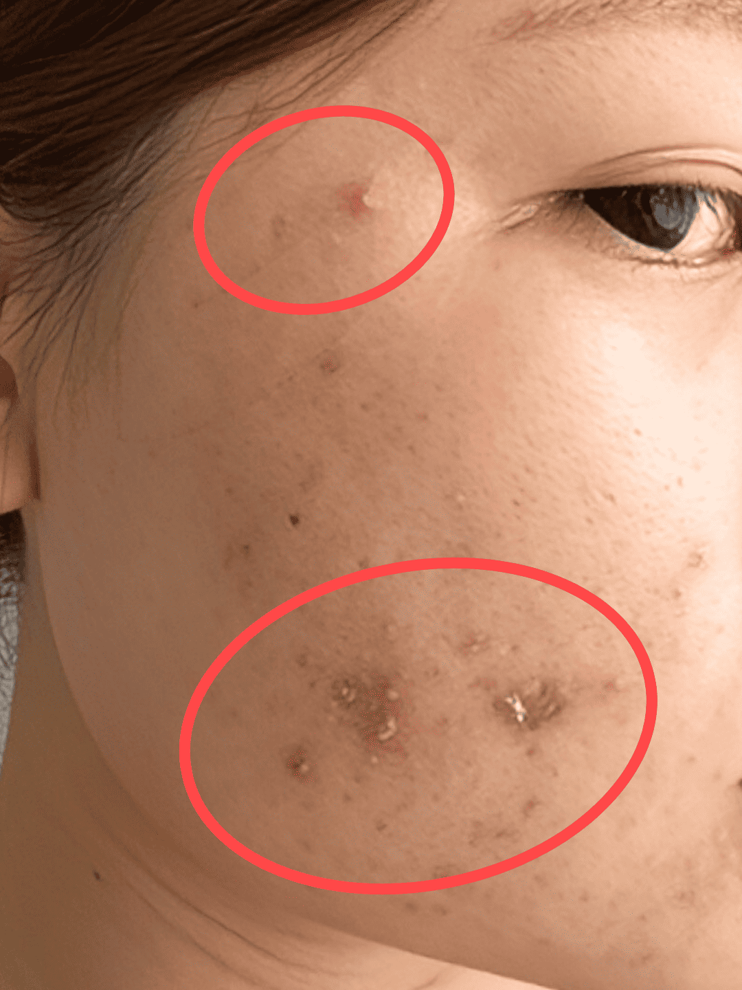 AP Lotion Challenge | Coslab Beauty Spa